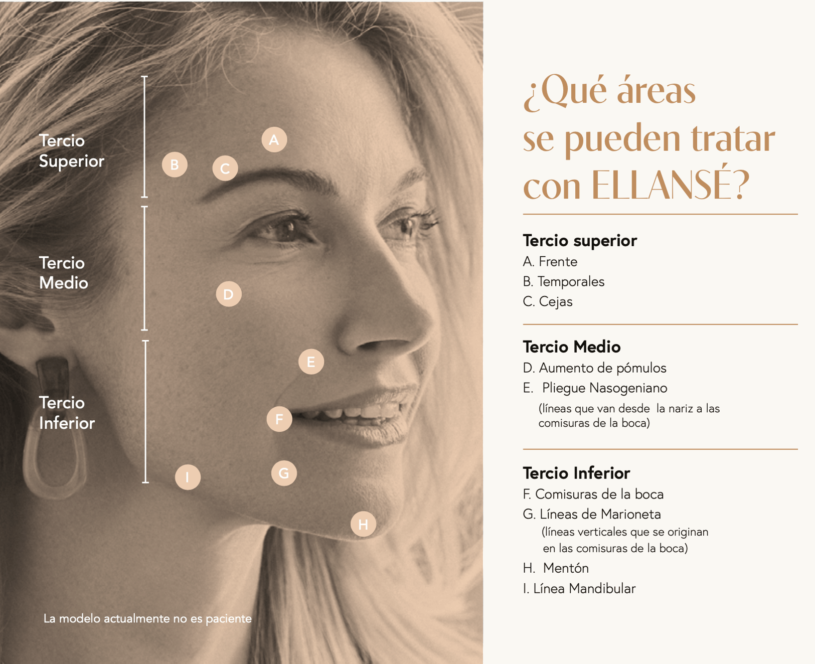 10 Beneficios de usar Ellanse